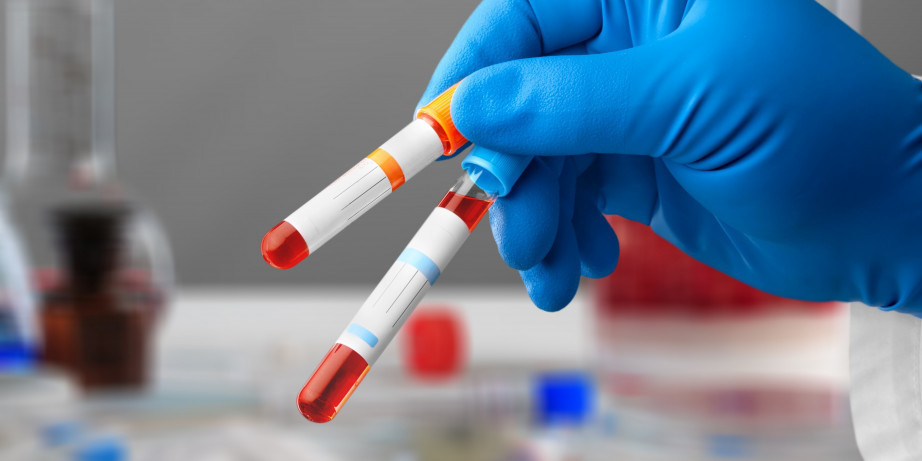 Biohemijska analiza krvi! | Popusti, kuponi i putovanja