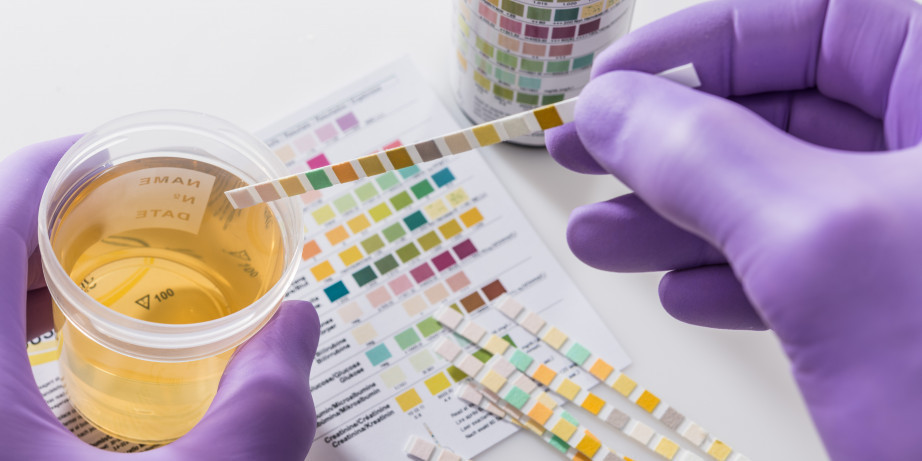 Paket briseva + urin i urinokultura! | Popusti, kuponi i akcije